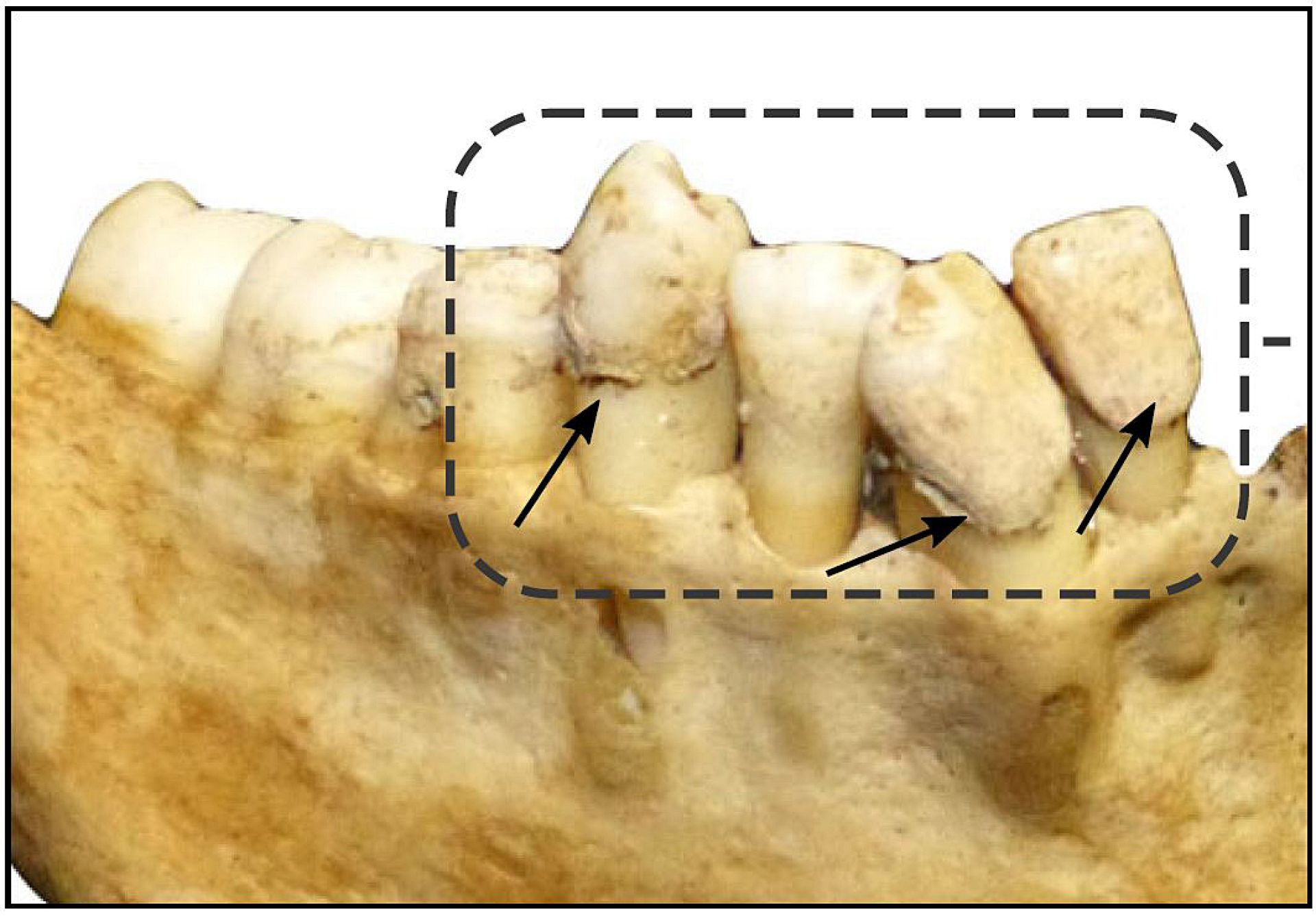 Dental plaque shows the ancients liked carbs | Euronews