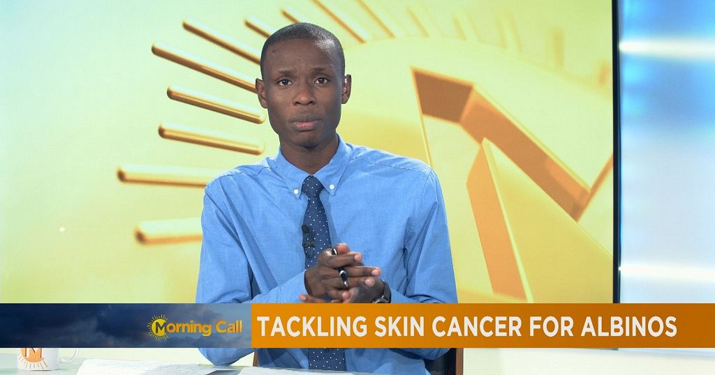 Senegalese sunscreens for albino [The Morning Call] | Africanews