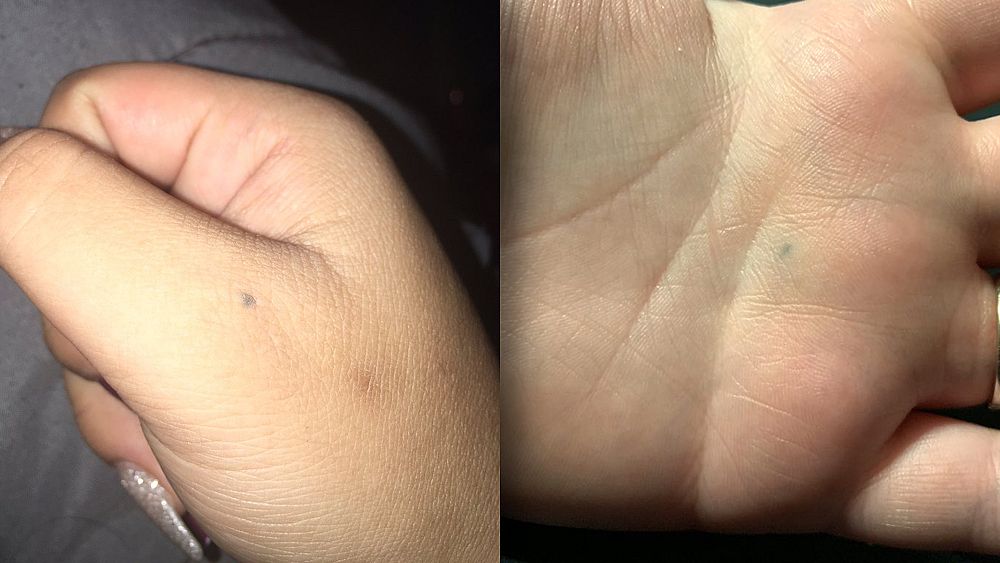 Here's how pencils can permanently 'tattoo' your skin | Euronews