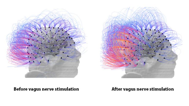 Man in vegetative state for 15 years 'shows signs of consciousness ...