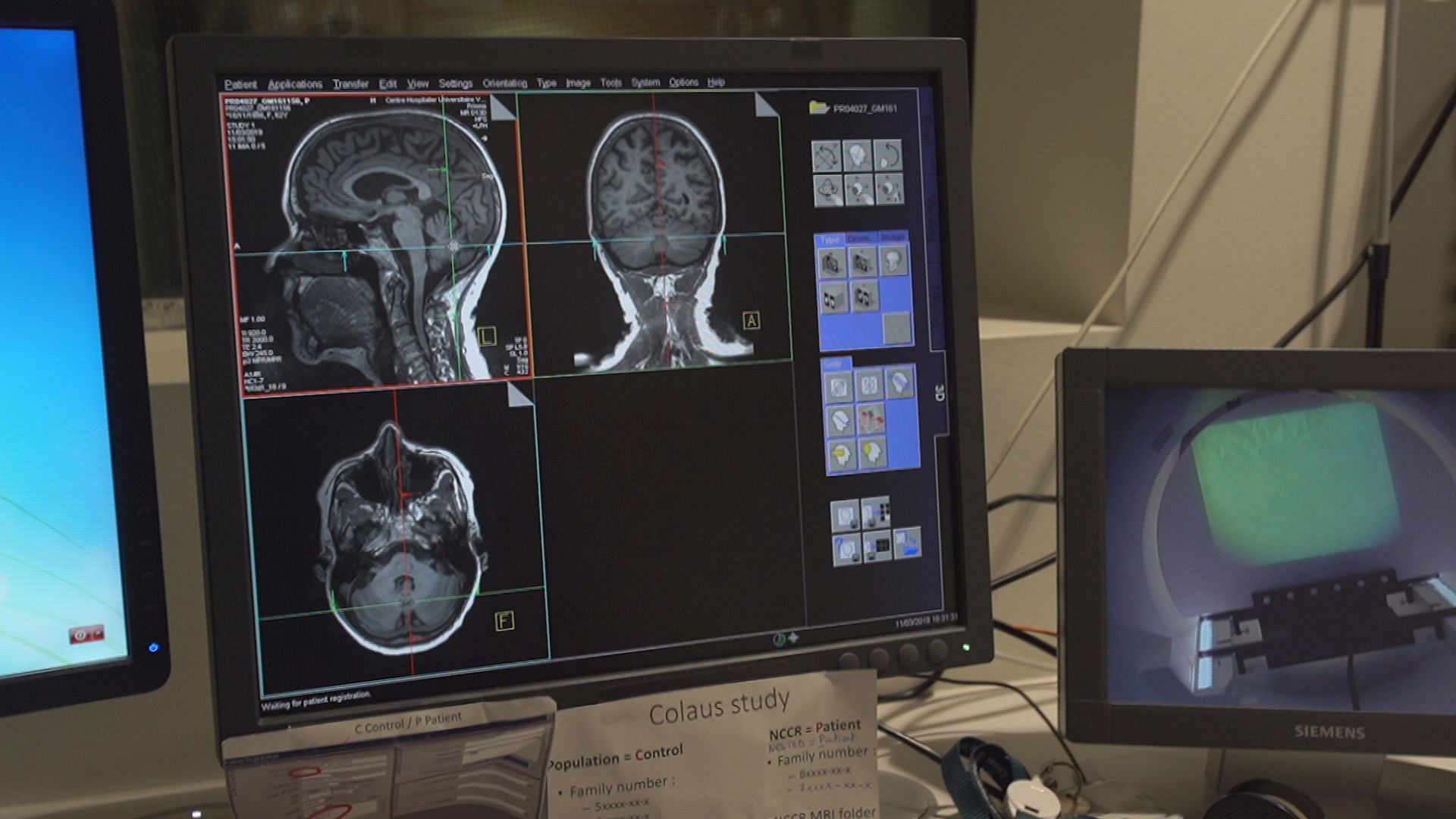The Human Brain Project: Slicing brains and thinking machines | Euronews