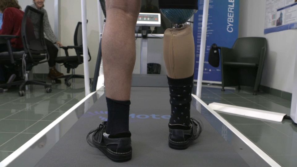 The robots making life easier for amputees | Euronews