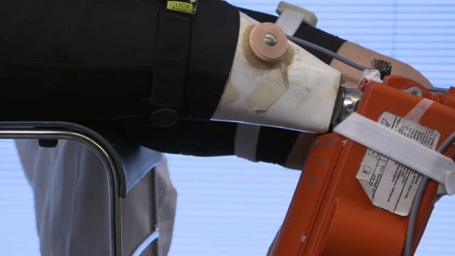 The robots making life easier for amputees | Euronews