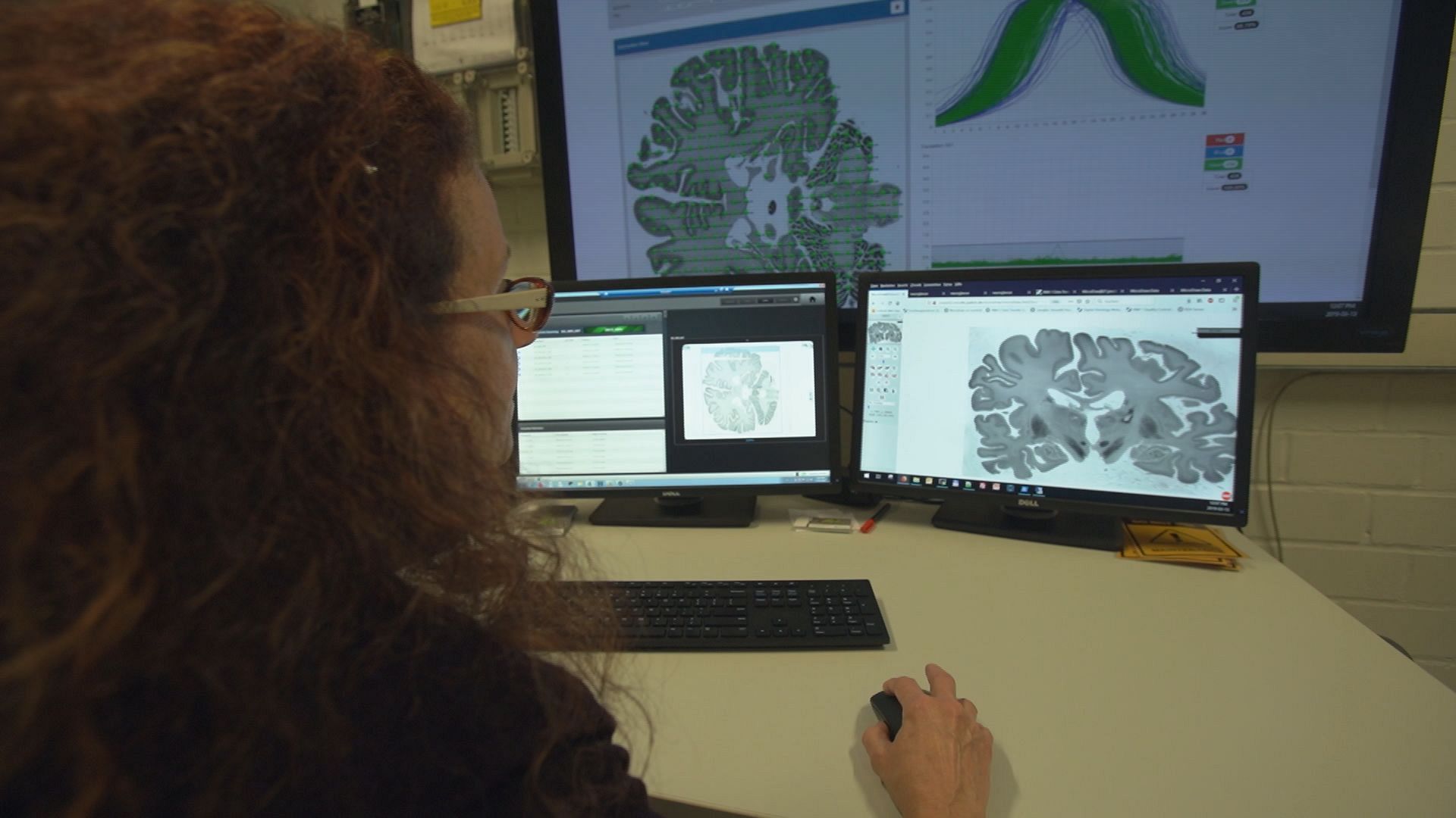 The Human Brain Project: Slicing brains and thinking machines | Euronews