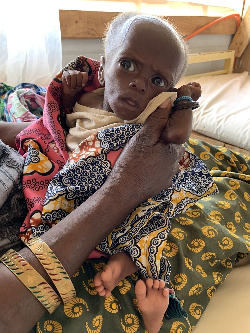 Niger: Mothers are the 'best asset' for early diagnosis of child ...