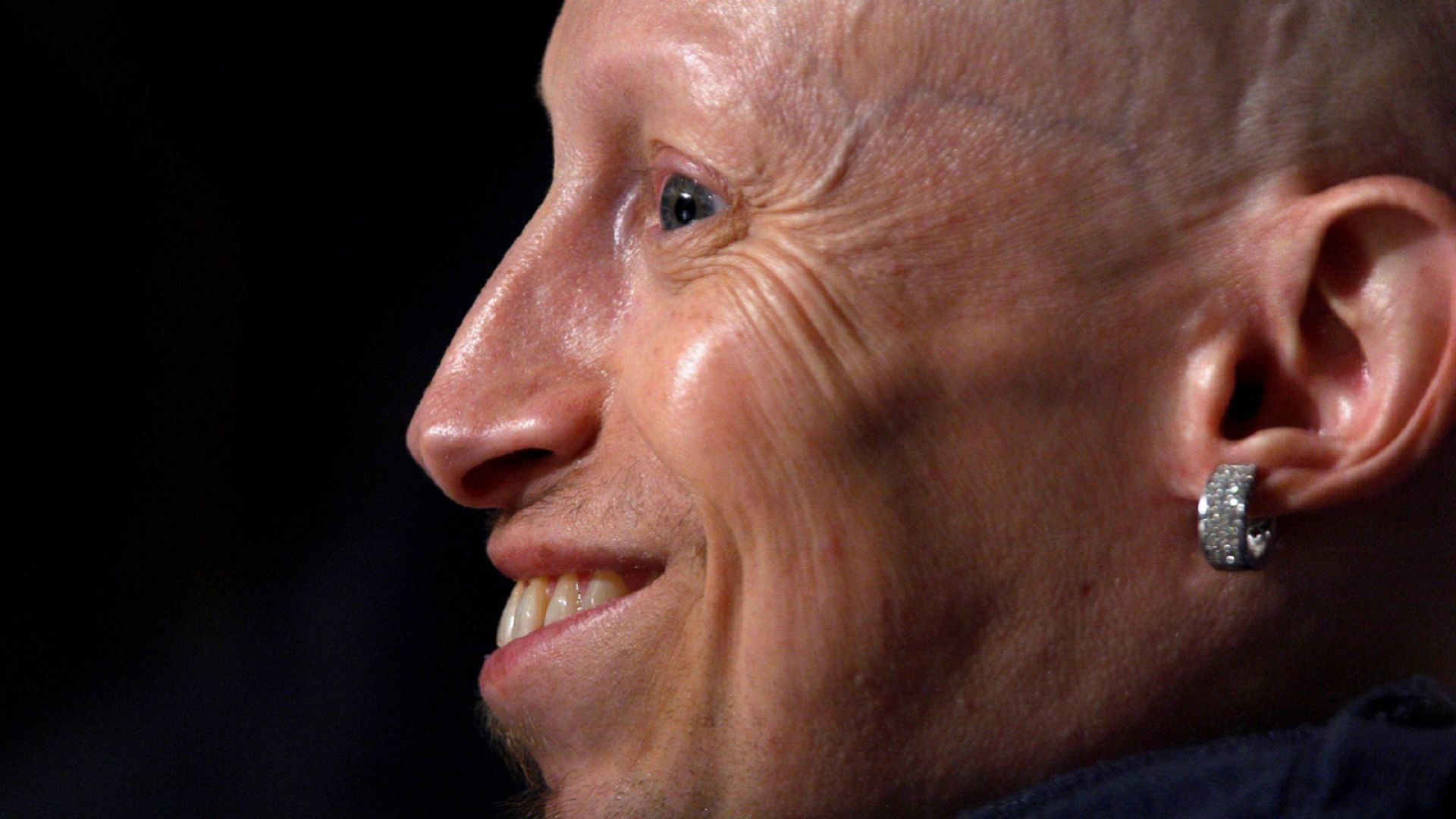 Mini-Me actor Verne Troyer dies at 49 | Euronews