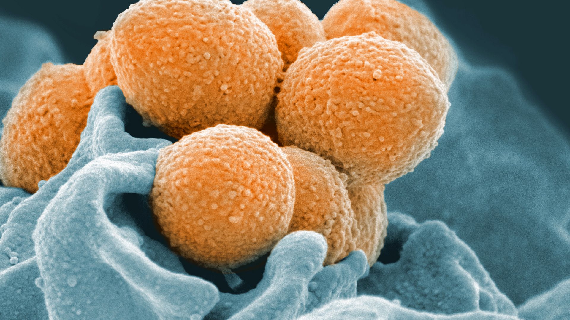 ¿Qué es el estreptococo A? Los síntomas que hay que vigilar en los ...