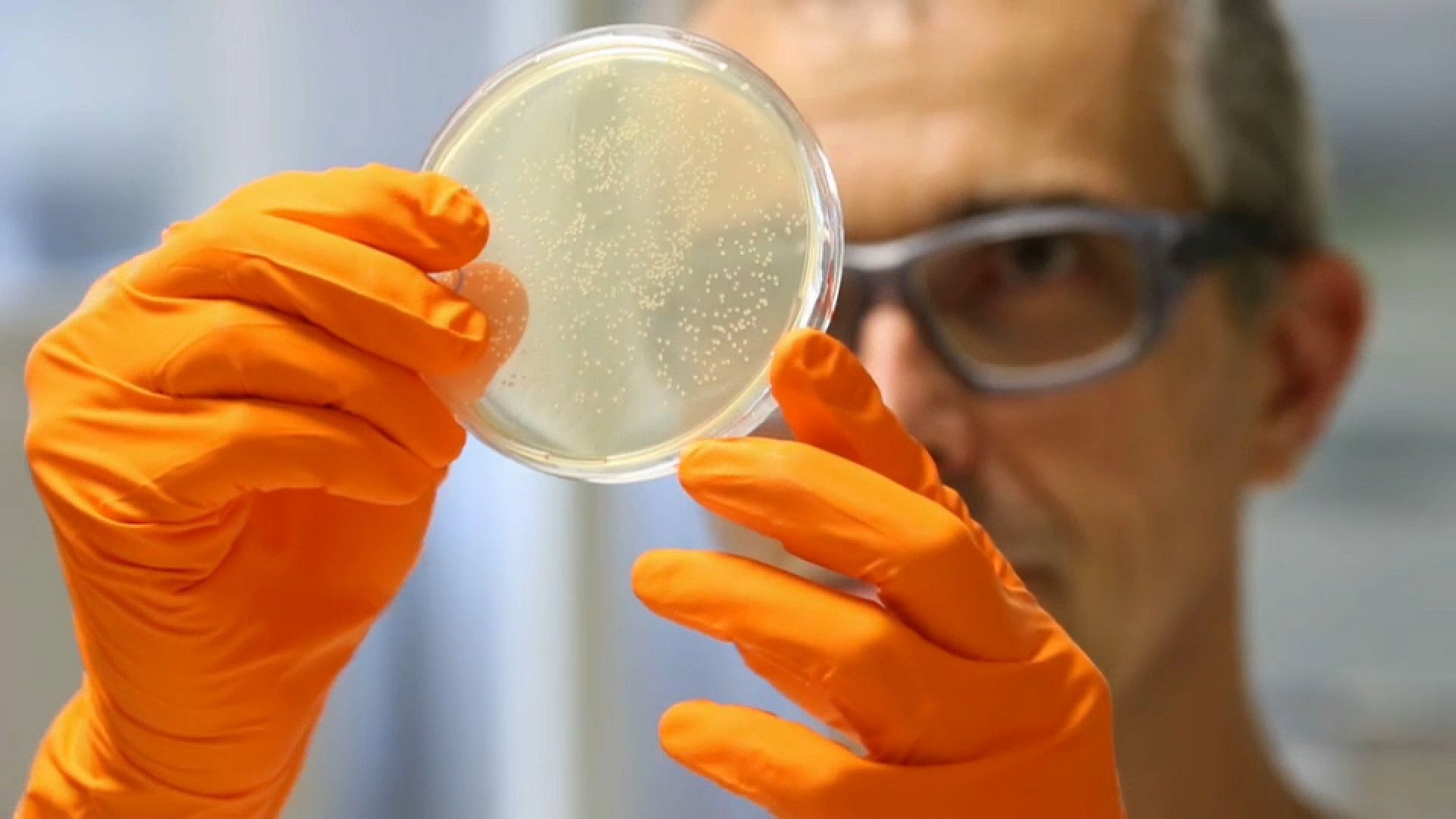 One million cancer cases undiagnosed in Europe due to pandemic, new ...