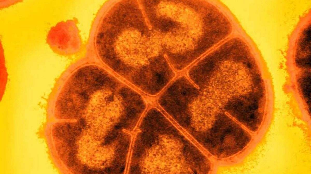Life on Mars? Research finds 280 million-year-old bacteria could be ...