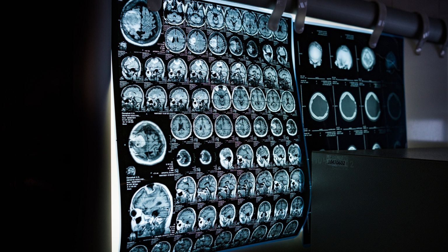 This German tech company's new MRI could save lives by detecting cancer ...