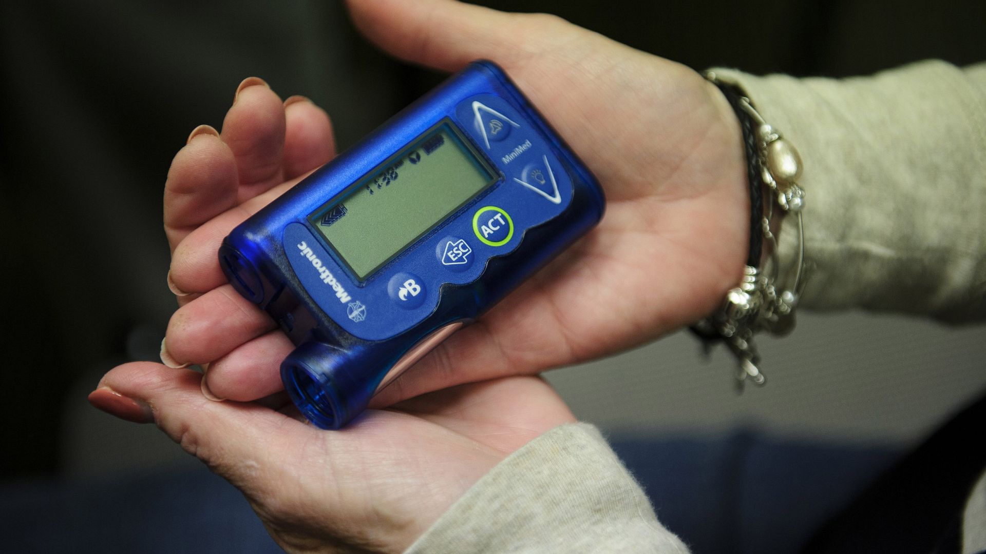 'Best option bar a cure': This artificial pancreas could be a game ...