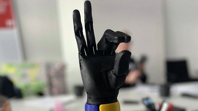 ‘Hero arms’: Wounded Ukrainian soldiers are being fitted with hi-tech ...