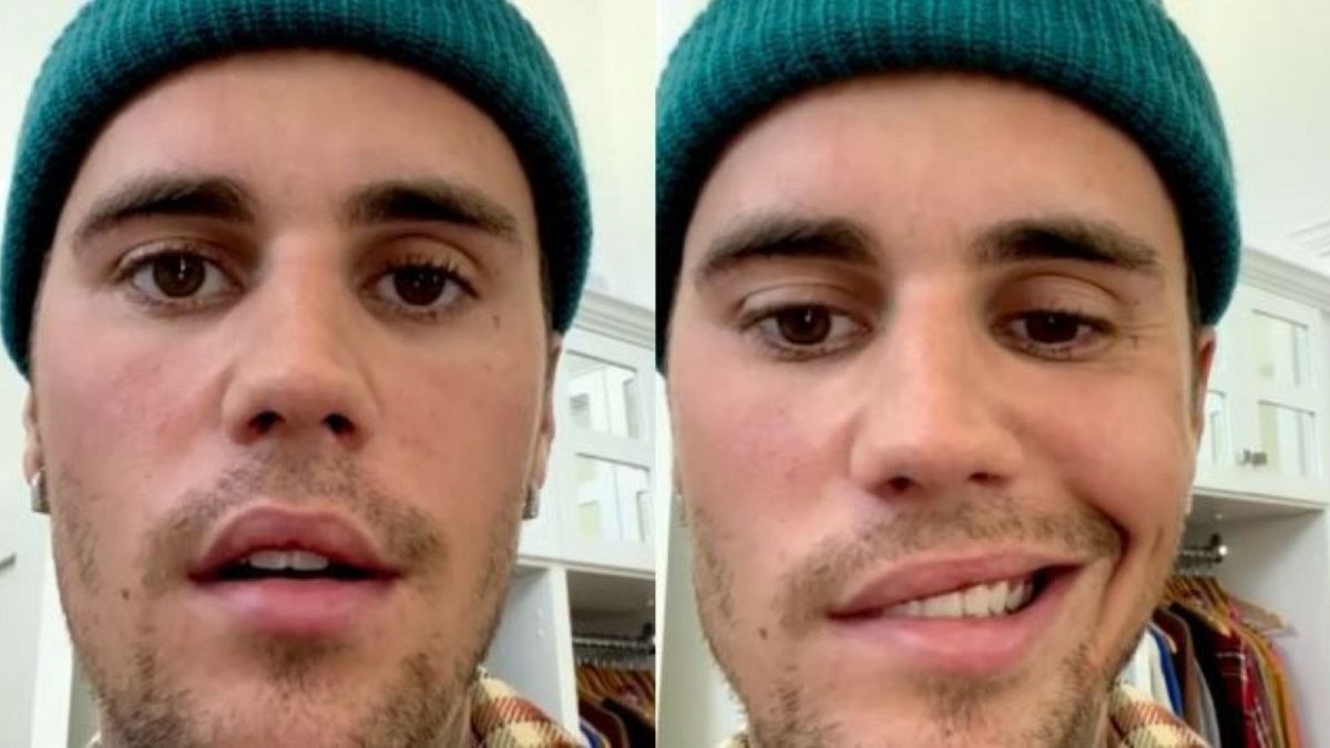 Justin Bieber cancels remaining tour dates following health issues ...