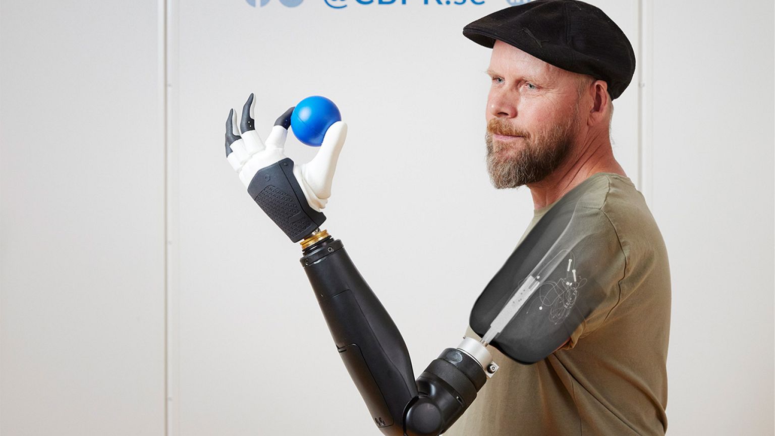 New bionic hand allows users to control each finger with unprecedented ...