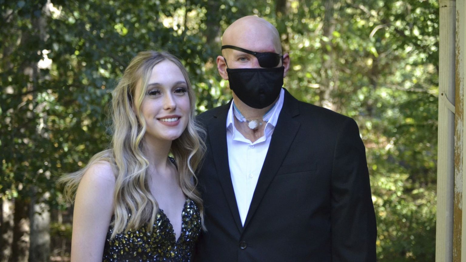 Un equipo de médicos de Nueva York lleva a cabo el primer trasplante de ojo de la historia ...