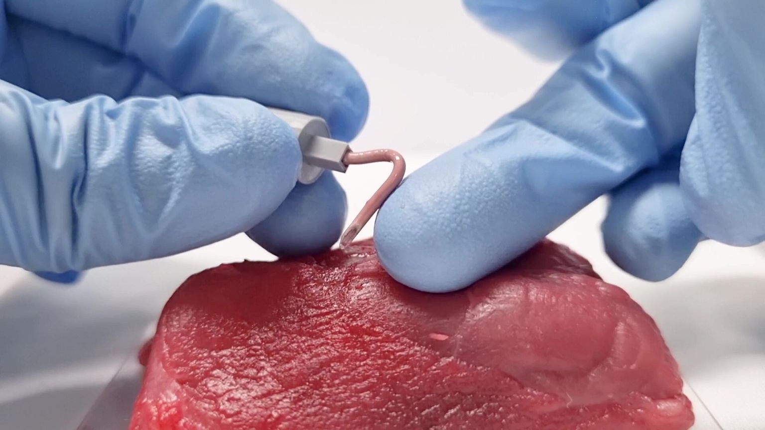 Scared of injections? New IV needle designed to go soft in the body ...