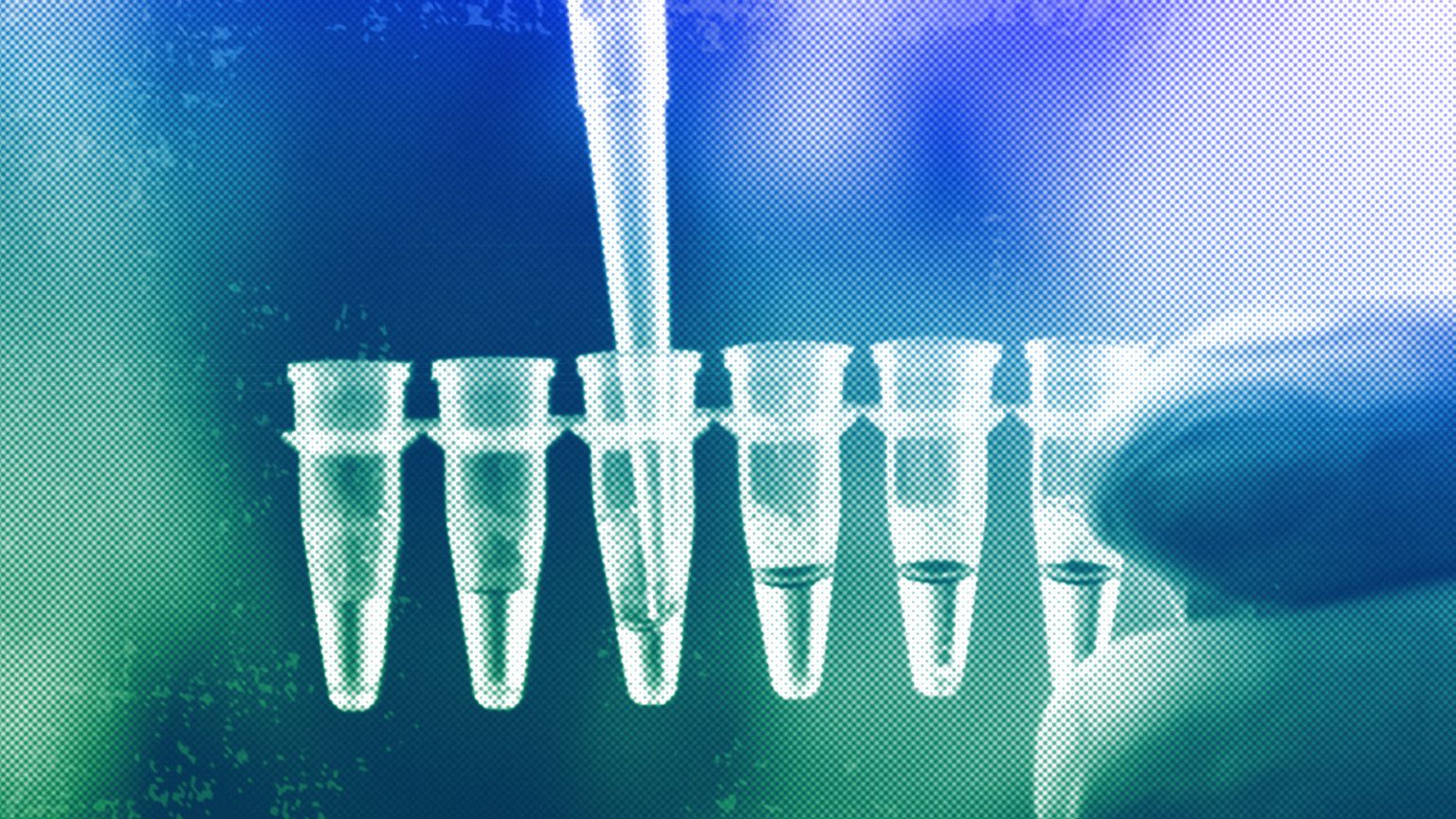 Brussels should know AI-assisted bioterrorism is a risk worth ...