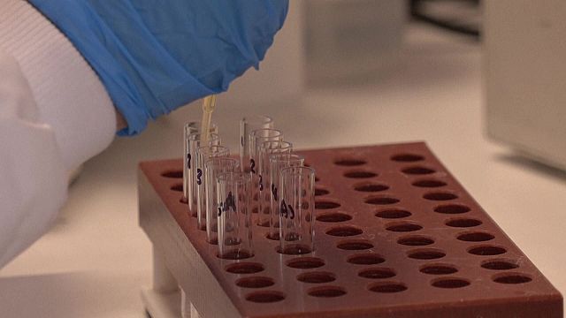 UK NHS is offering a world first 'blood matching' test to treat sickle ...