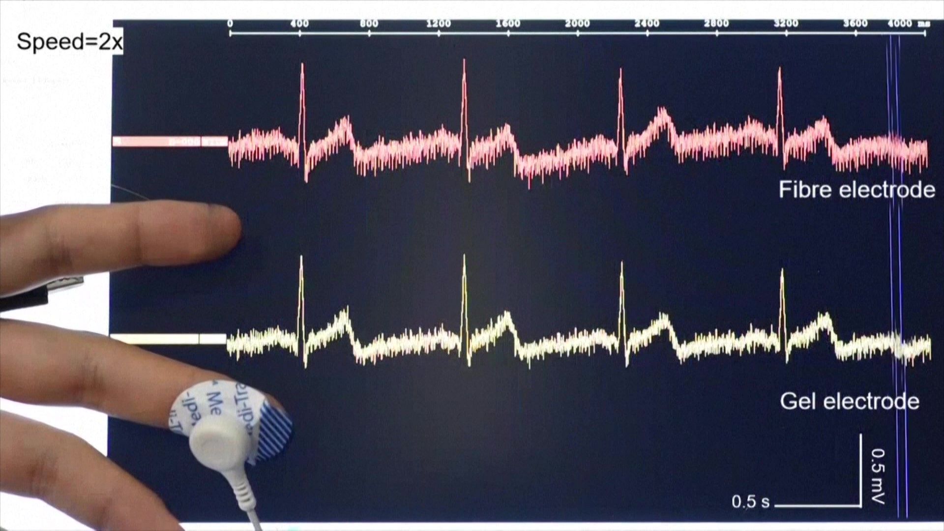 These sensors are as fine as spider's silk and can monitor human health ...