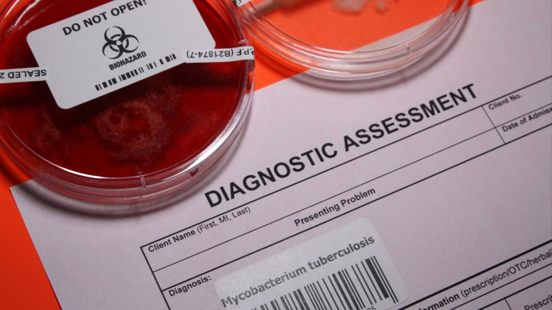 Países europeus estão a ficar aquém na luta contra o HIV, tuberculose e ...