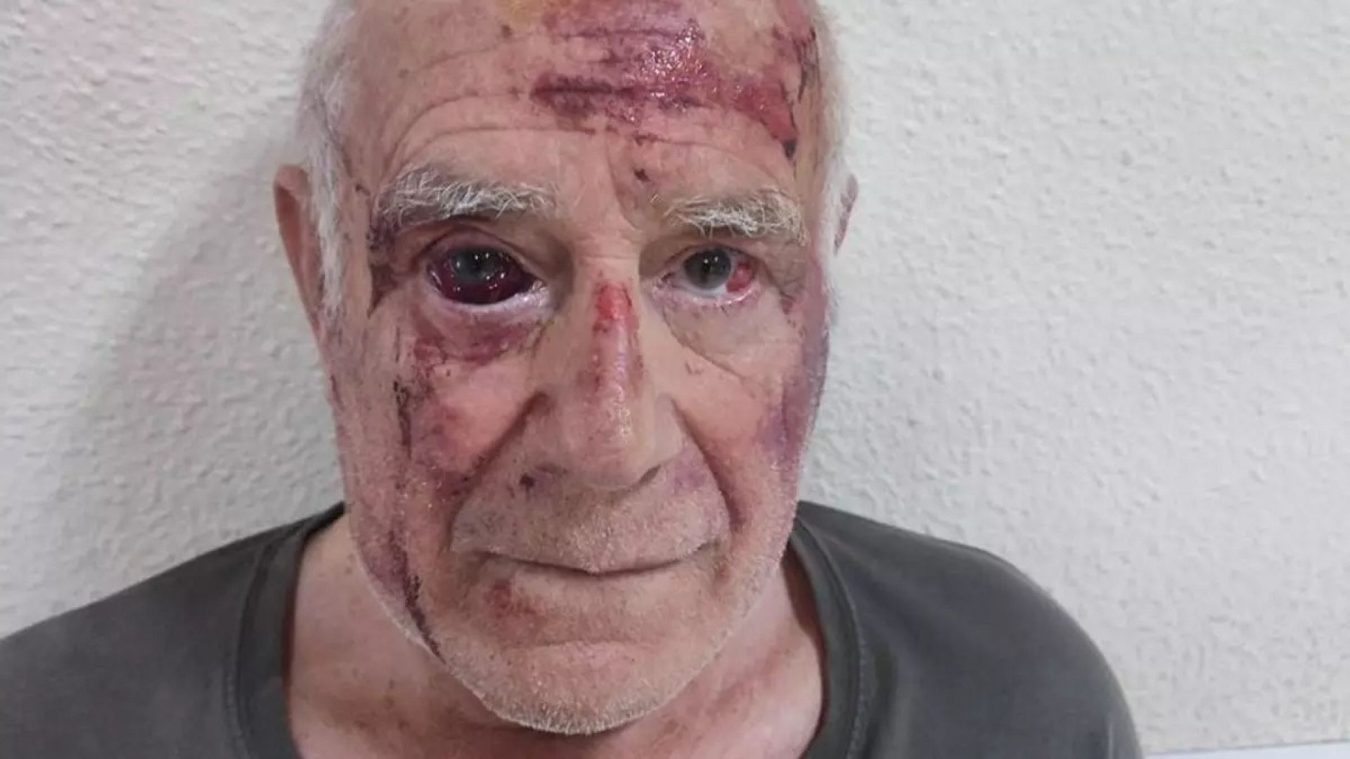 Espagne : une attaque filmée d’un vieil homme alimente les tensions à ...