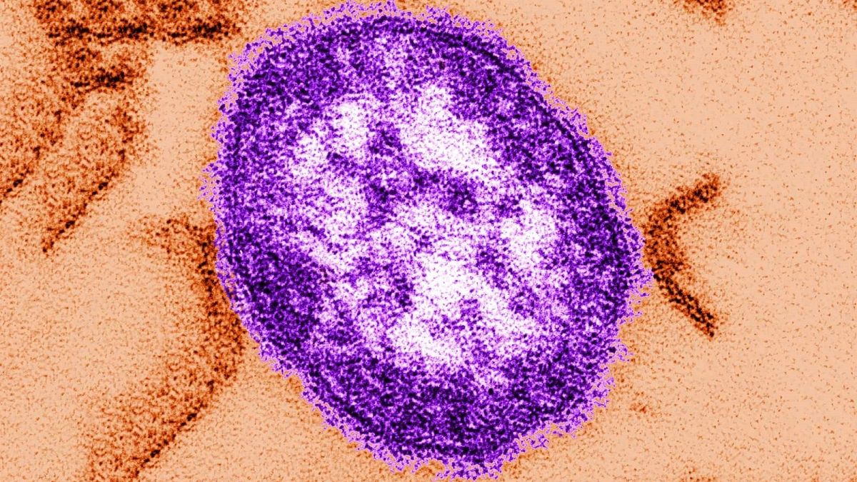 ABD'de kızamık rekoru: En kötü senaryoda 51 milyon vaka görülebilir ...